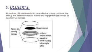 Approaches to overcome the barriers of Ocular drug delivery systems | PPT