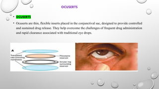 OCULAR DRUG DELIVERY SYSTEMS. Novel Drug Delivery System.pptx