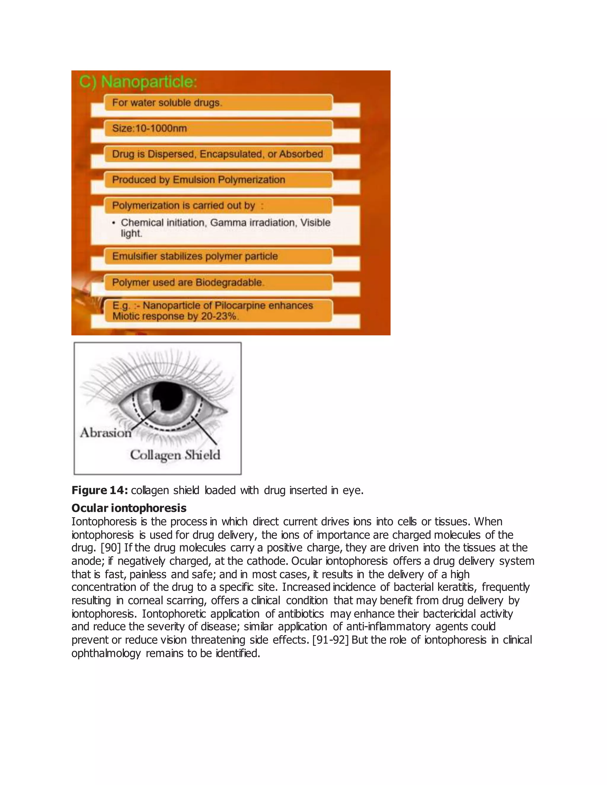 overview of Ocular drug delivery systems | PDF
