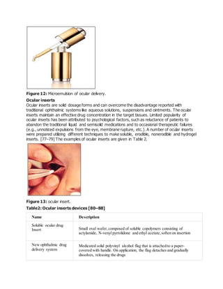 overview of Ocular drug delivery systems | PDF