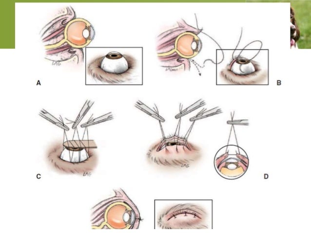 Ocular emergencies