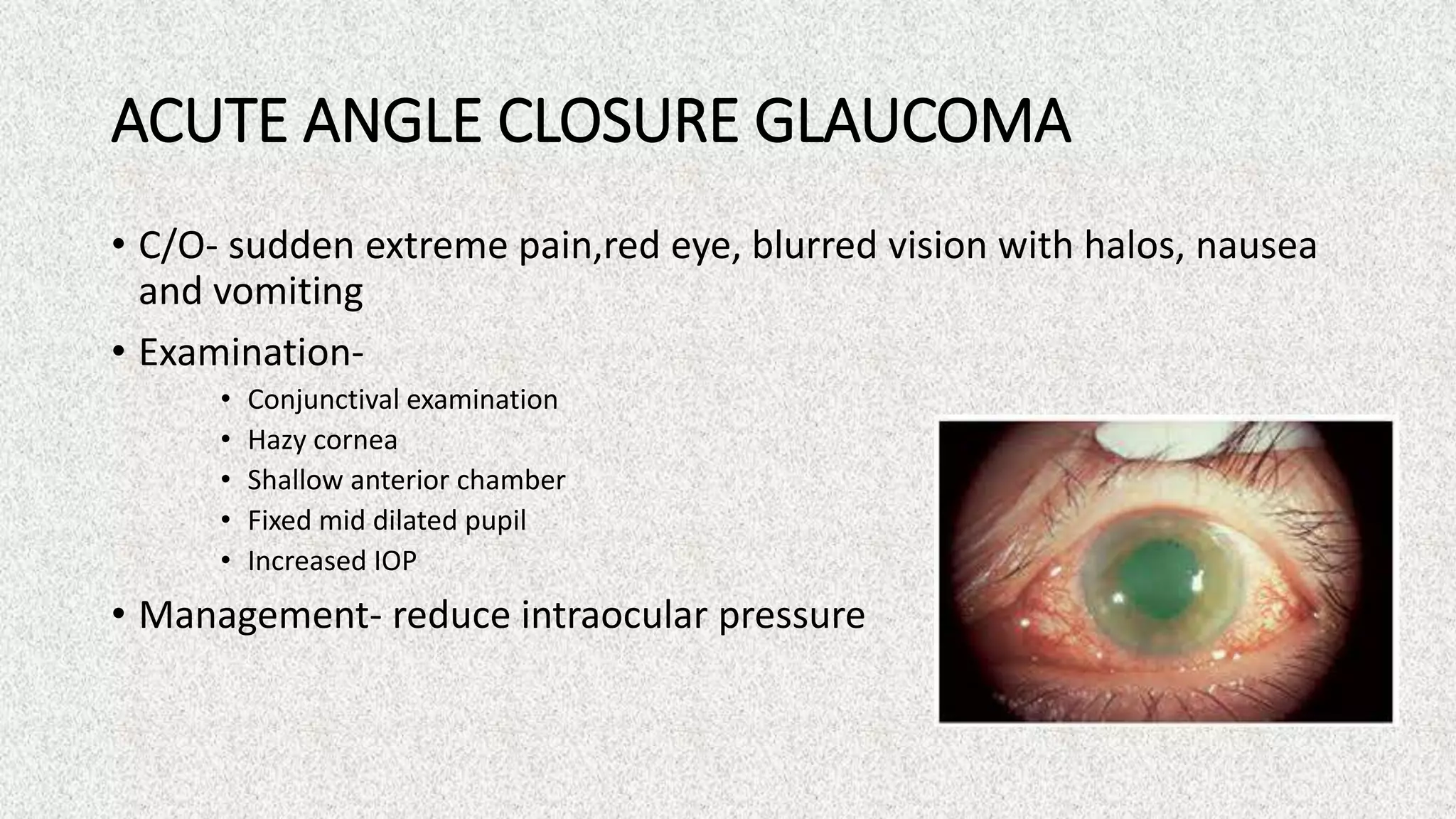 Ocular emergencies | PPTX