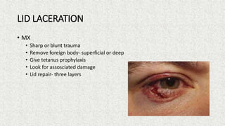 Ocular emergencies | PPTX