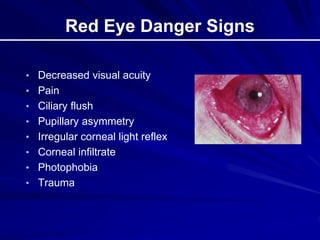 Ocular emergencies.ppt