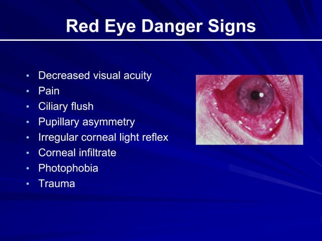 Ocular emergencies.ppt | Eye and Vision Conditions | Diseases and ...