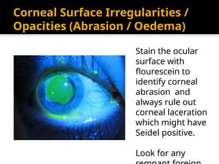 ocular emergencies in kkm malaysia today.ppt
