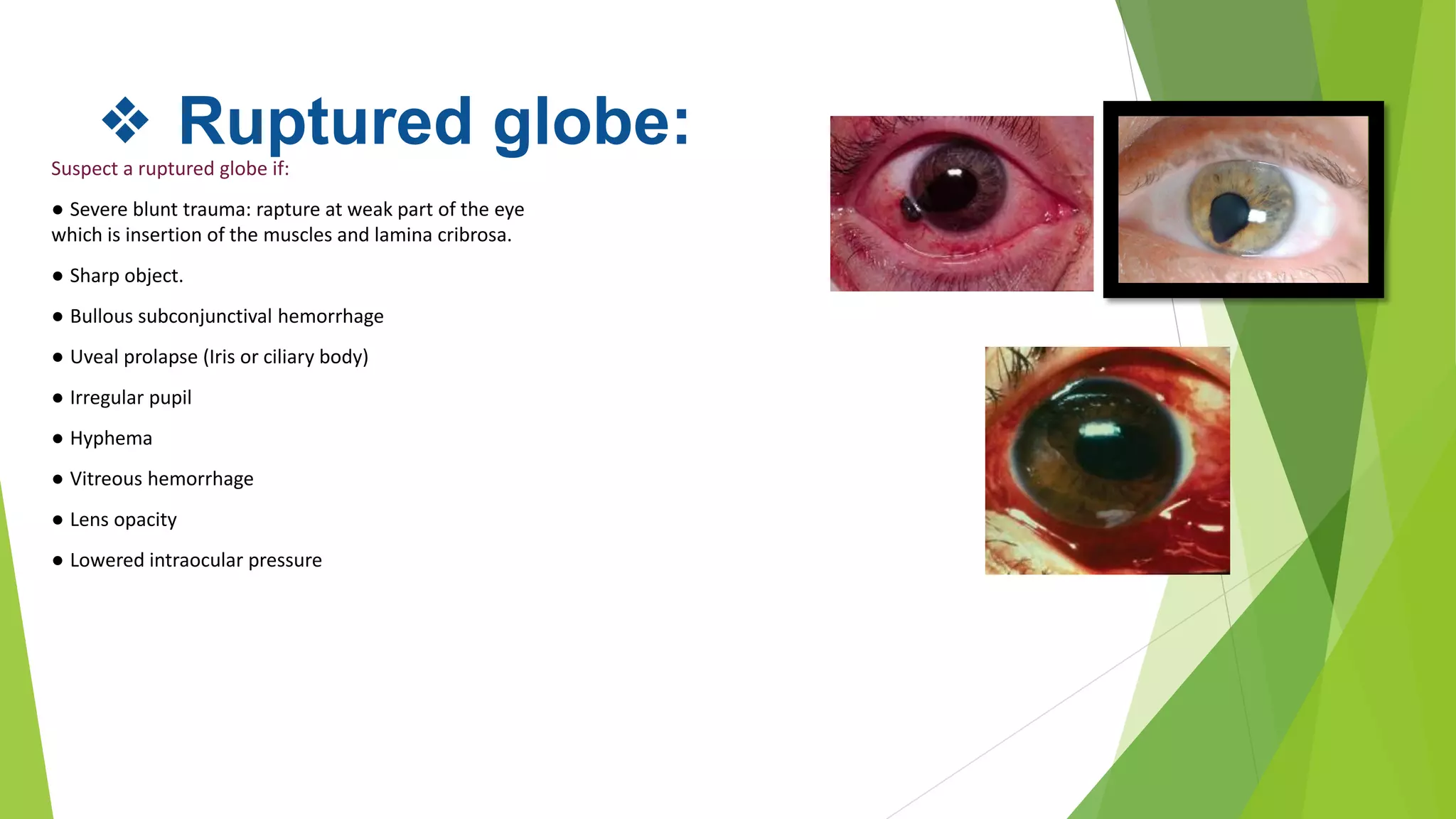 Ocular Emergencies dr Wisudawan SpM _ Kelaskedokteran.pdf