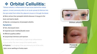 Ocular Emergencies dr Wisudawan SpM _ Kelaskedokteran.pdf