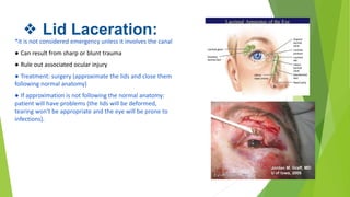 Ocular Emergencies dr Wisudawan SpM _ Kelaskedokteran.pdf