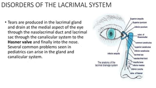 OCULAR EMERGENCIES IN PEDIATRICS [Autosaved].pptx