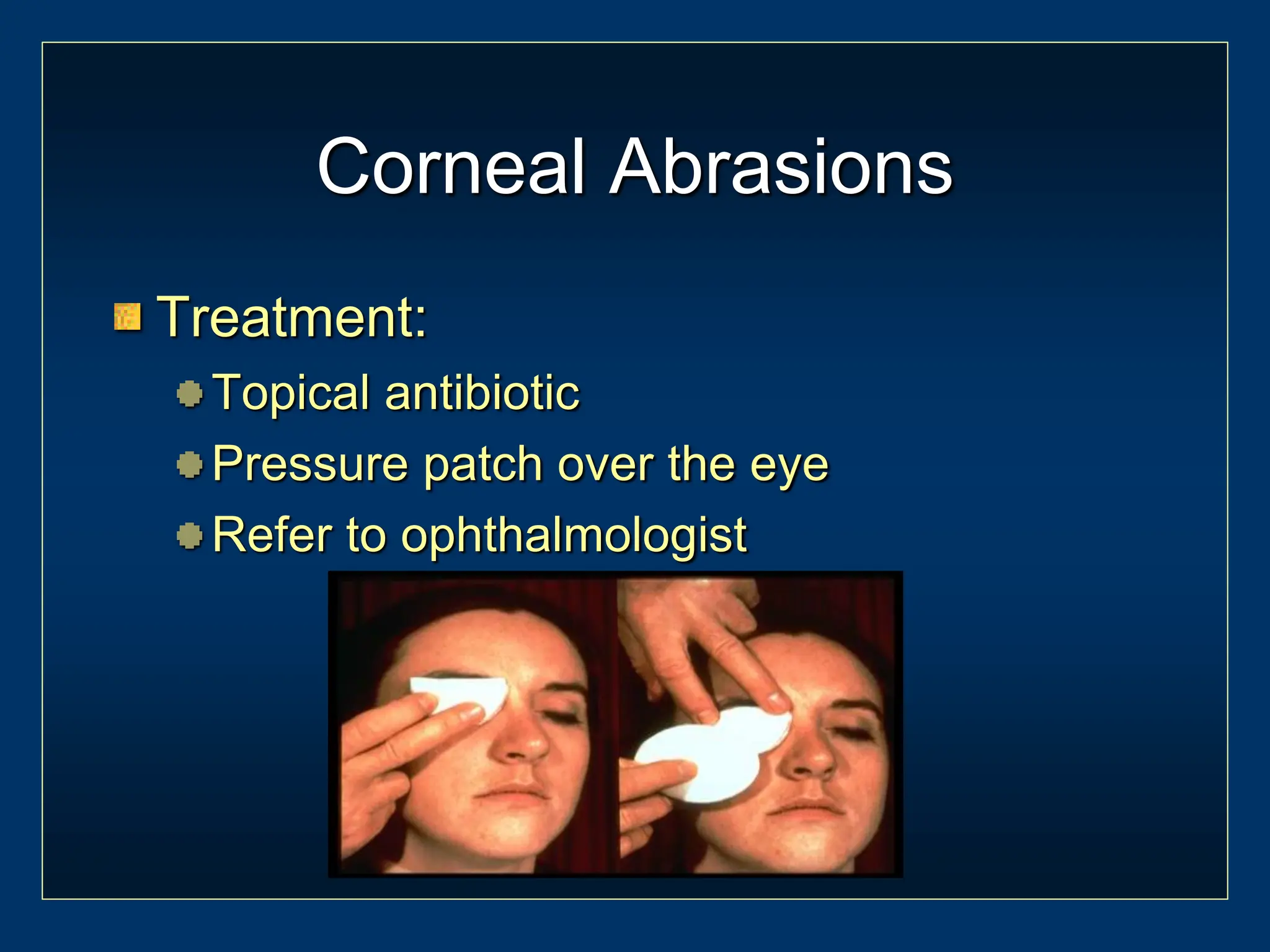 Ocular Emergencies and Red Eye Presentation w | PPT