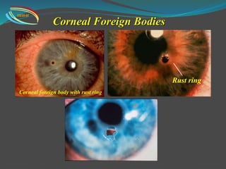 Ocular Emergencies | PPTX