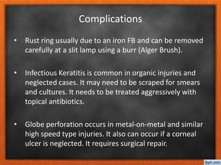 Ocular Foreign Body | PPTX