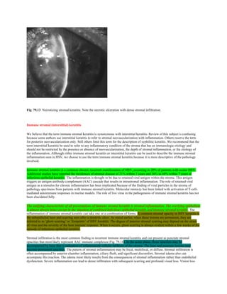 Ocular manifestaions of HSV infection by Qutaiba Alnahi | PDF