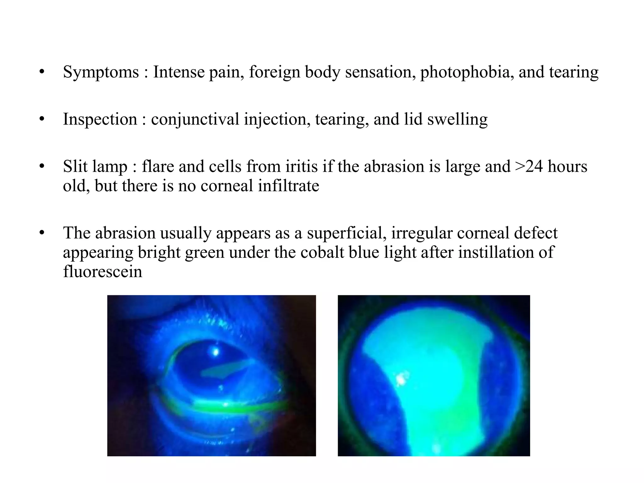 Ocular injuries | PPTX