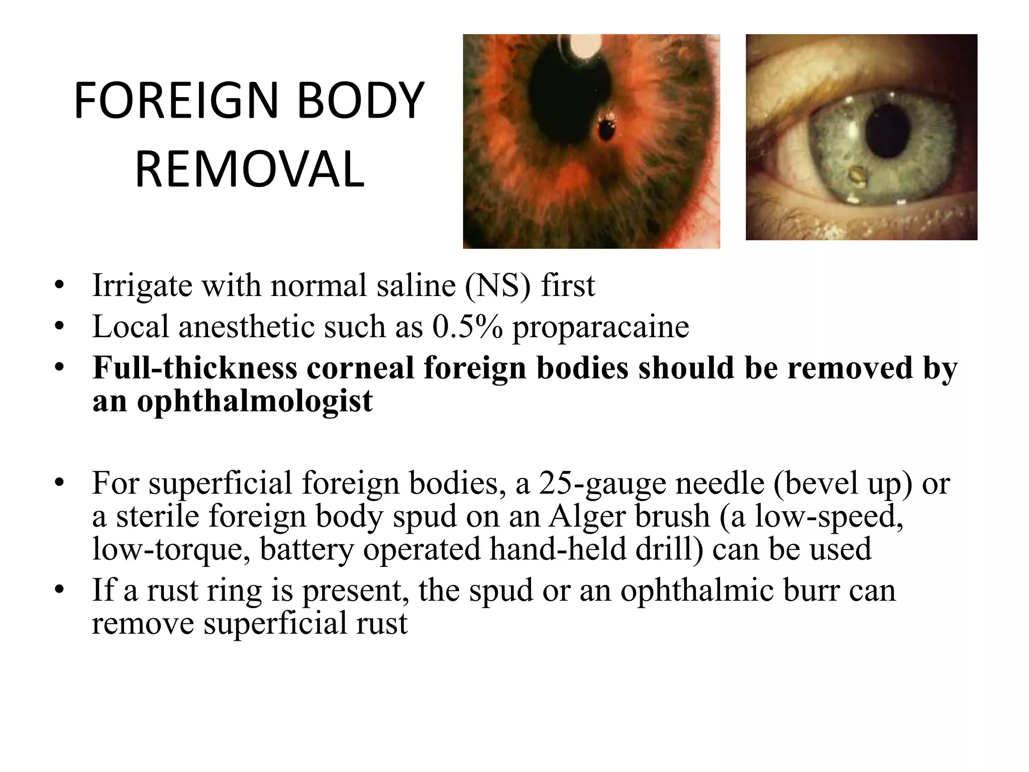 Ocular injuries | PPTX