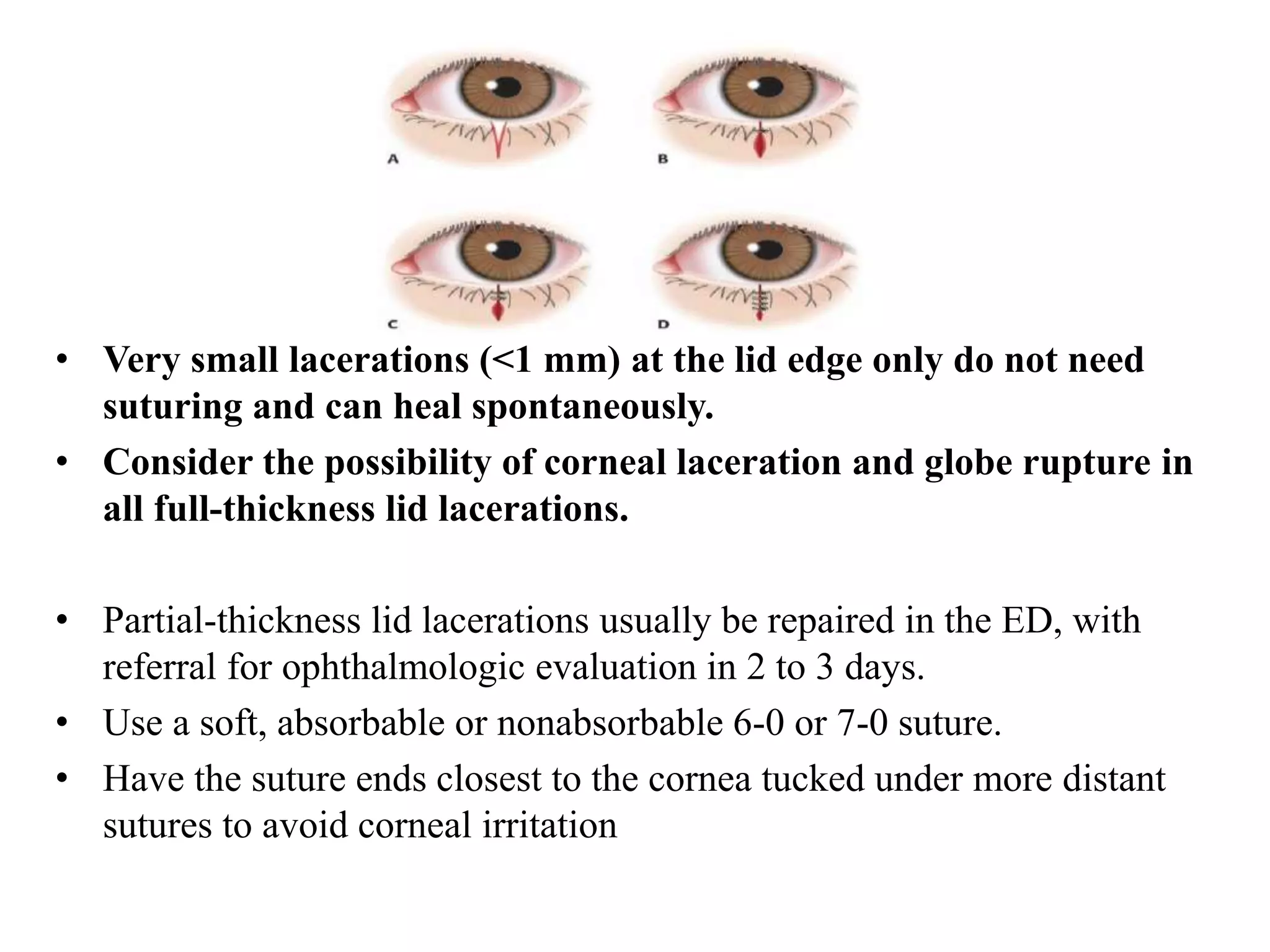 Ocular injuries | PPTX