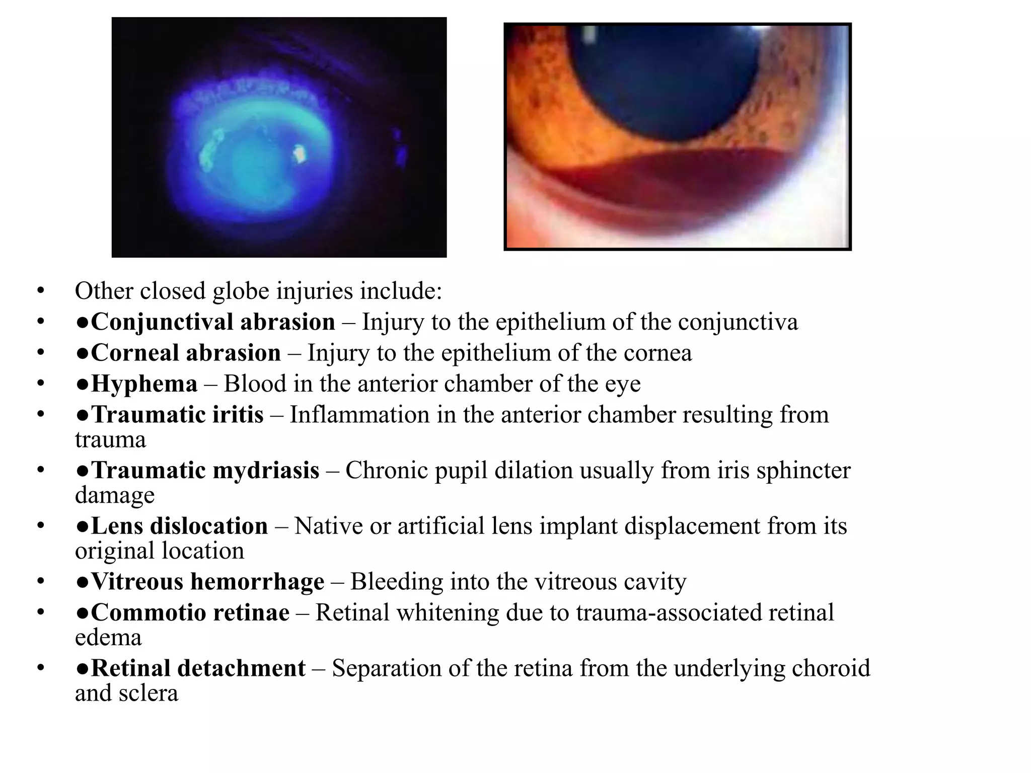Ocular injuries | PPTX