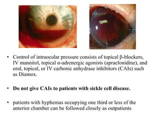 Ocular injuries | PPTX