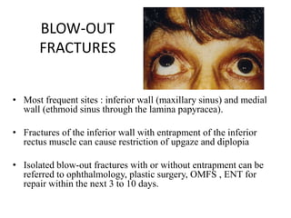 Ocular injuries | PPTX