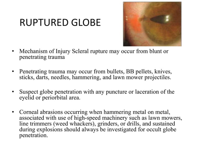 Ocular injuries | PPT | Free Download
