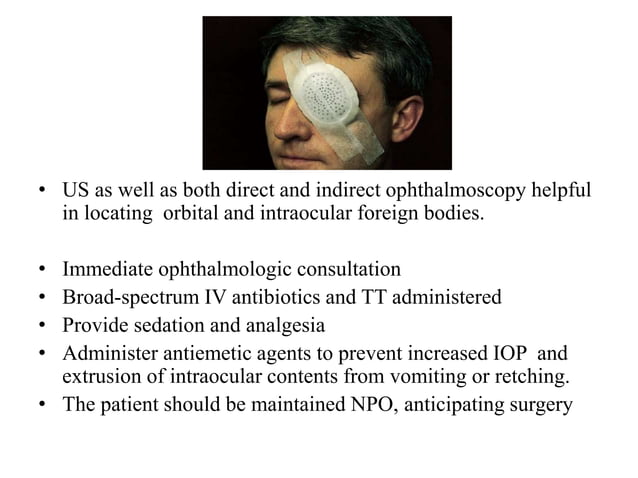 Ocular injuries | PPTX