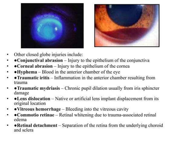 Ocular injuries | PPTX