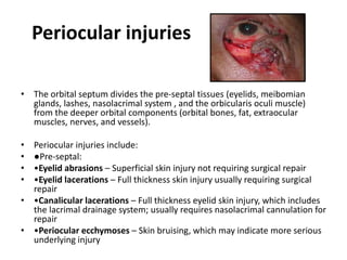 Ocular injuries | PPTX