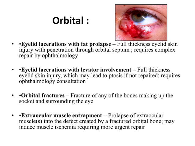 Ocular injuries | PPT | Free Download