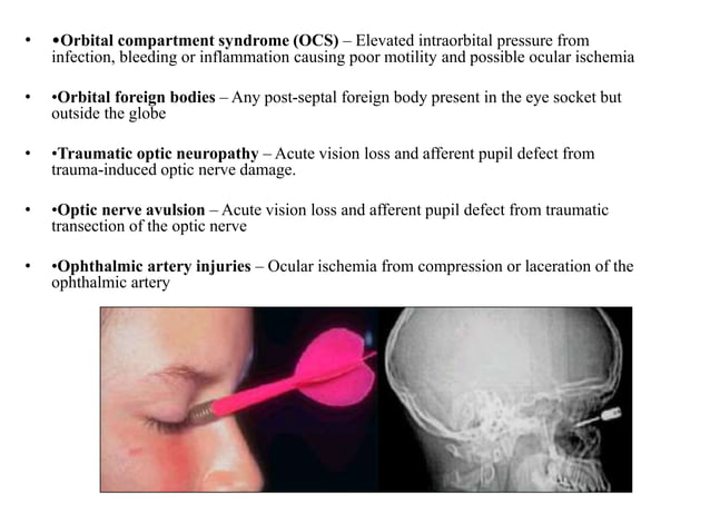 Ocular injuries | PPTX