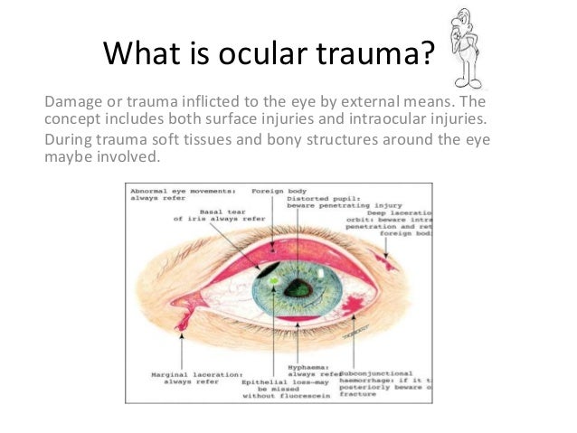 Ocular injuries
