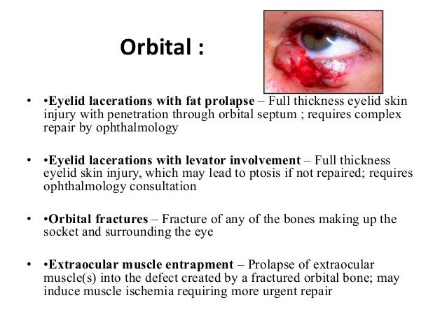 Ocular injuries