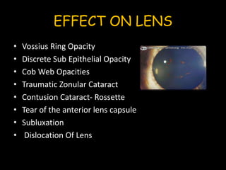 Ocular injuries | PPTX
