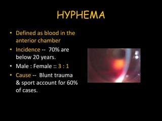 Ocular injuries | PPTX