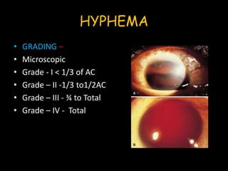 Ocular injuries | PPTX