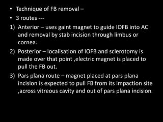 Ocular injuries | PPTX