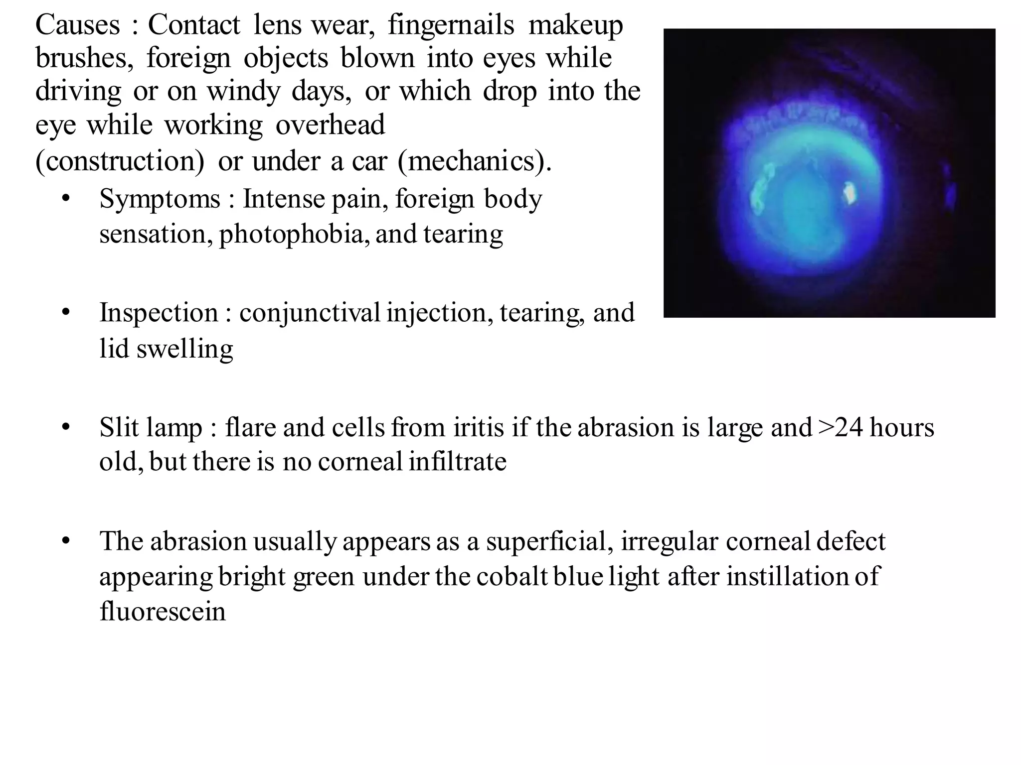 Ocular injuries | DOCX