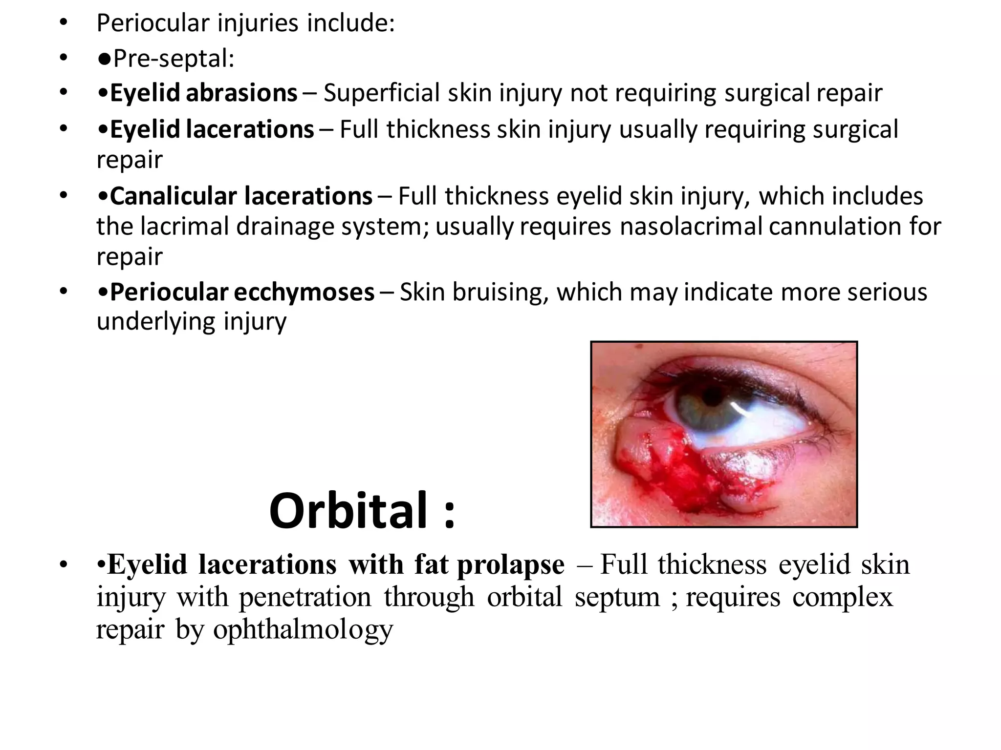 Ocular injuries | DOCX