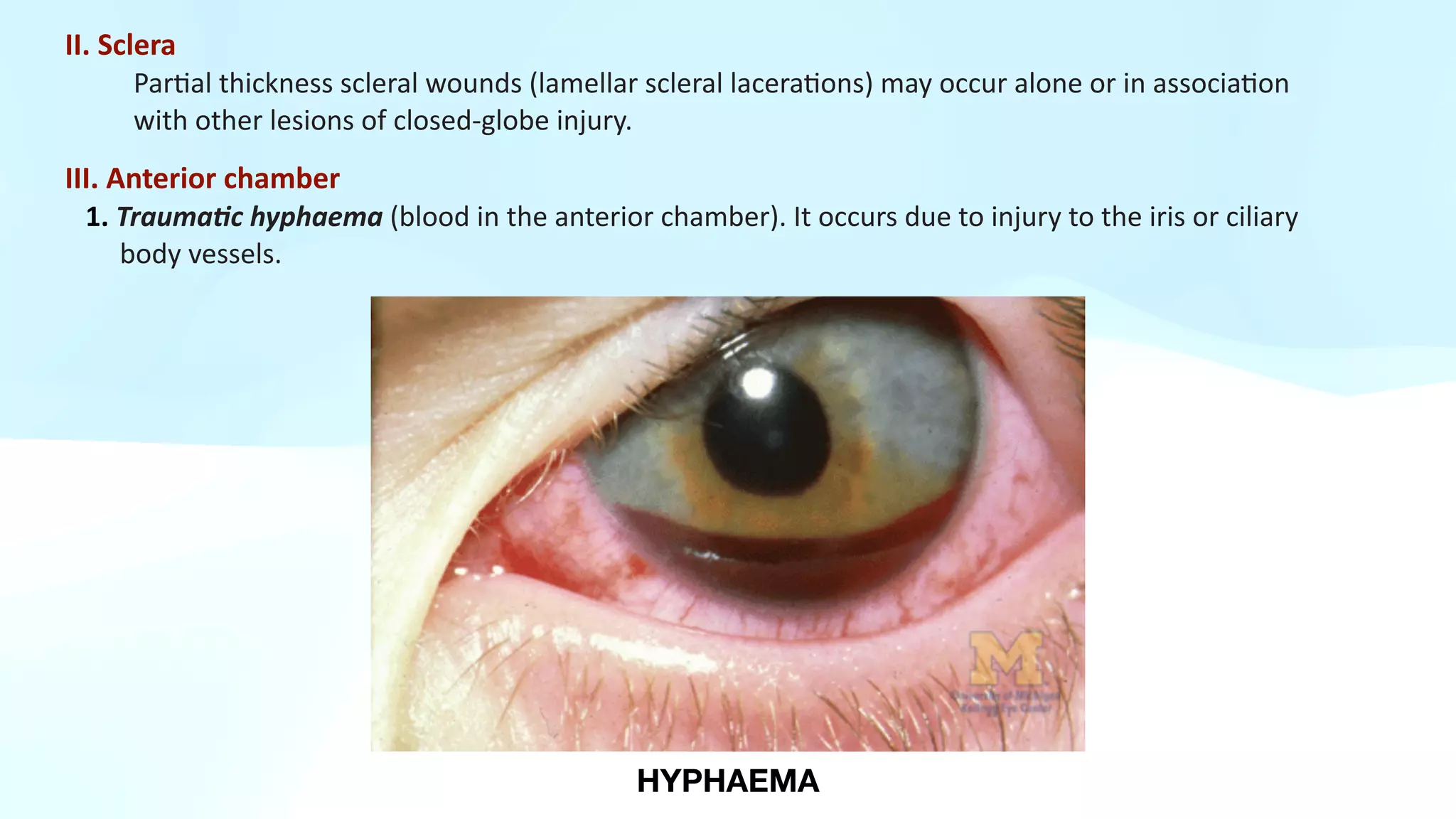OCULAR INJURIES | PDF