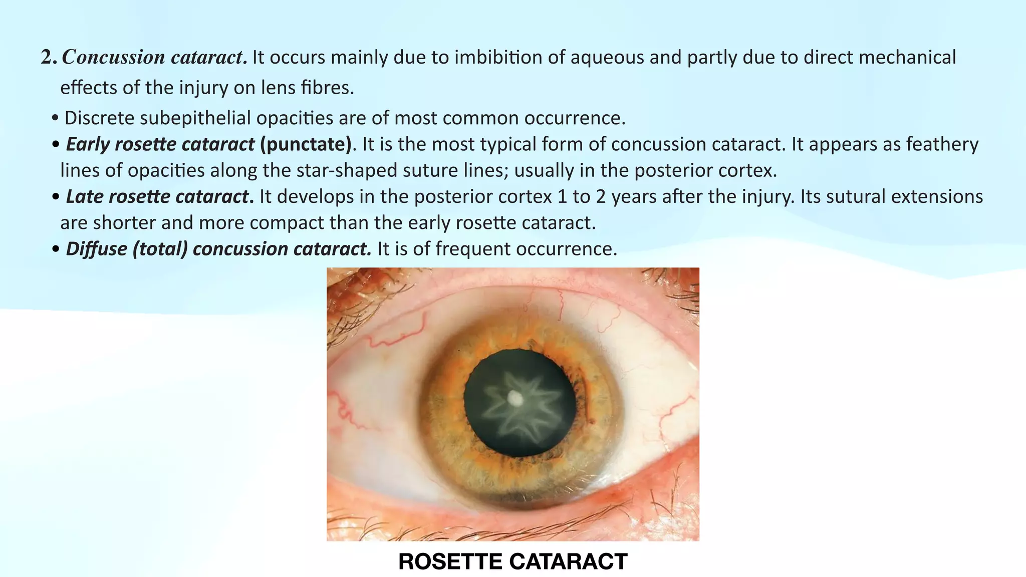 OCULAR INJURIES | PDF
