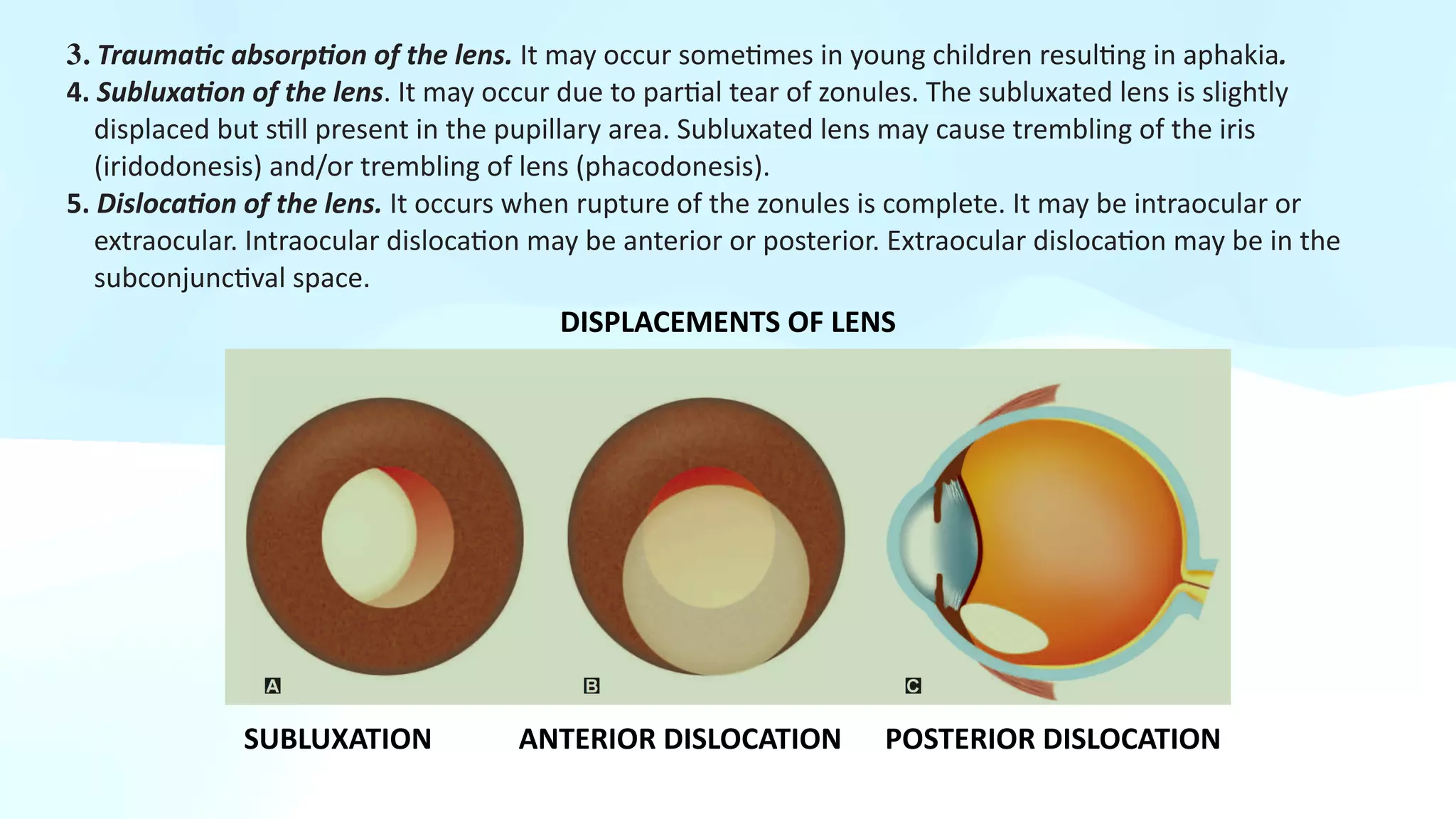 OCULAR INJURIES | PDF
