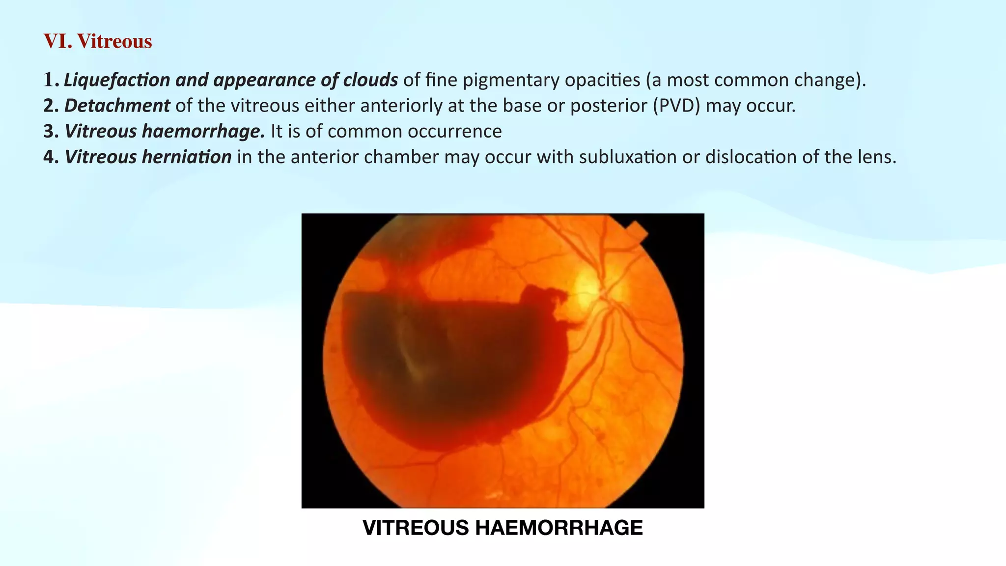 OCULAR INJURIES | PDF