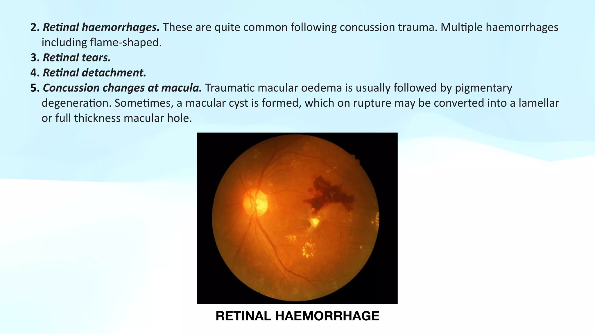 OCULAR INJURIES | PDF