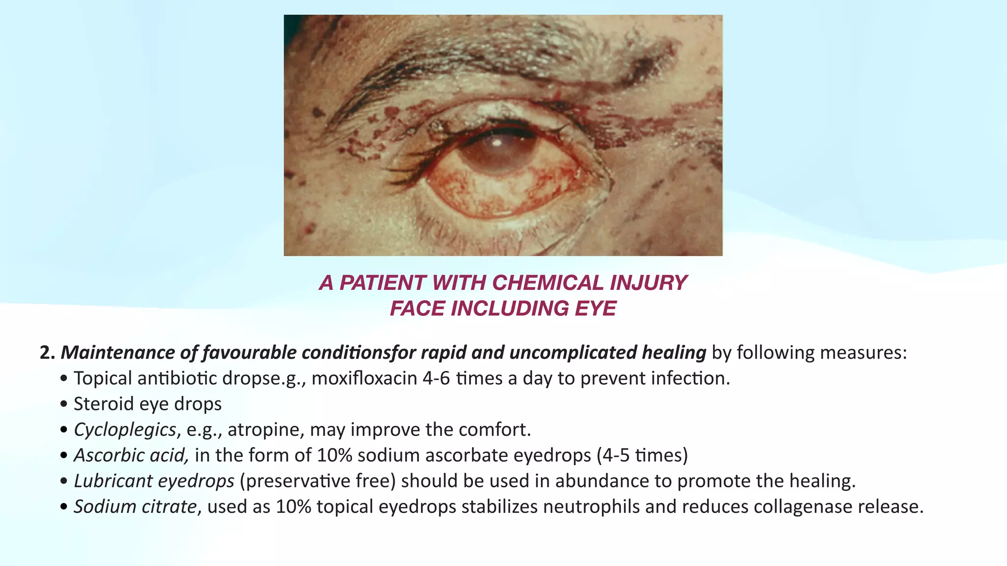 OCULAR INJURIES | PDF