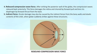 OCULAR INJURIES | PDF
