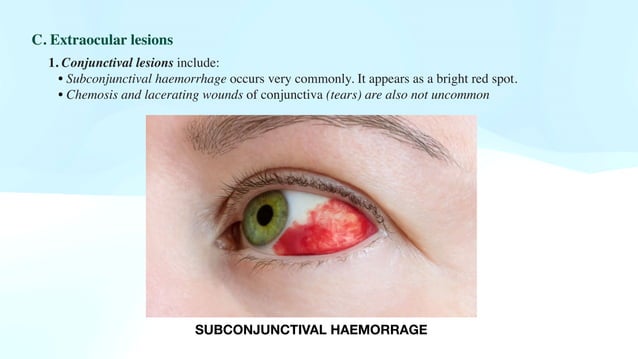 OCULAR INJURIES | PDF