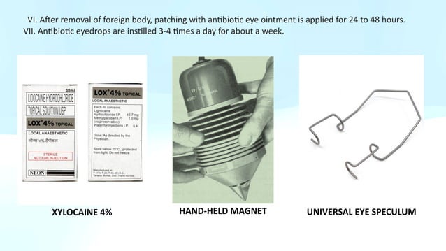 OCULAR INJURIES | PDF