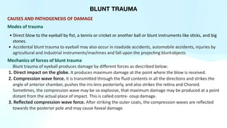 OCULAR INJURIES | PDF