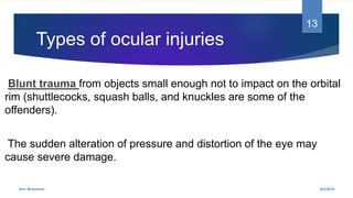 Ocular injuries for undergraduate students | PPTX