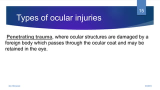 Ocular injuries for undergraduate students | PPTX